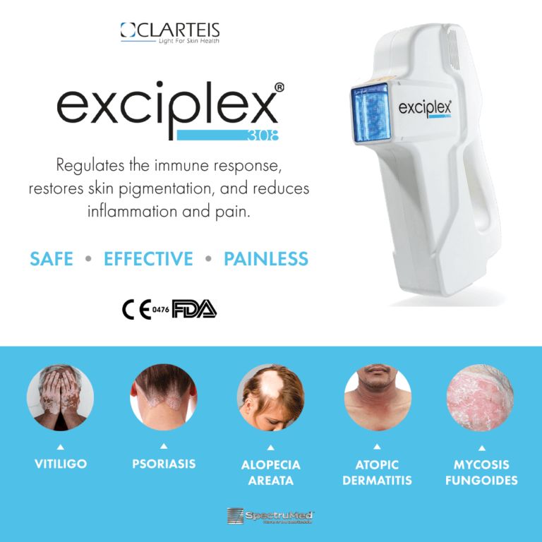 Top 5 Applications of the Exciplex® Treatment - SpectruMed Inc.